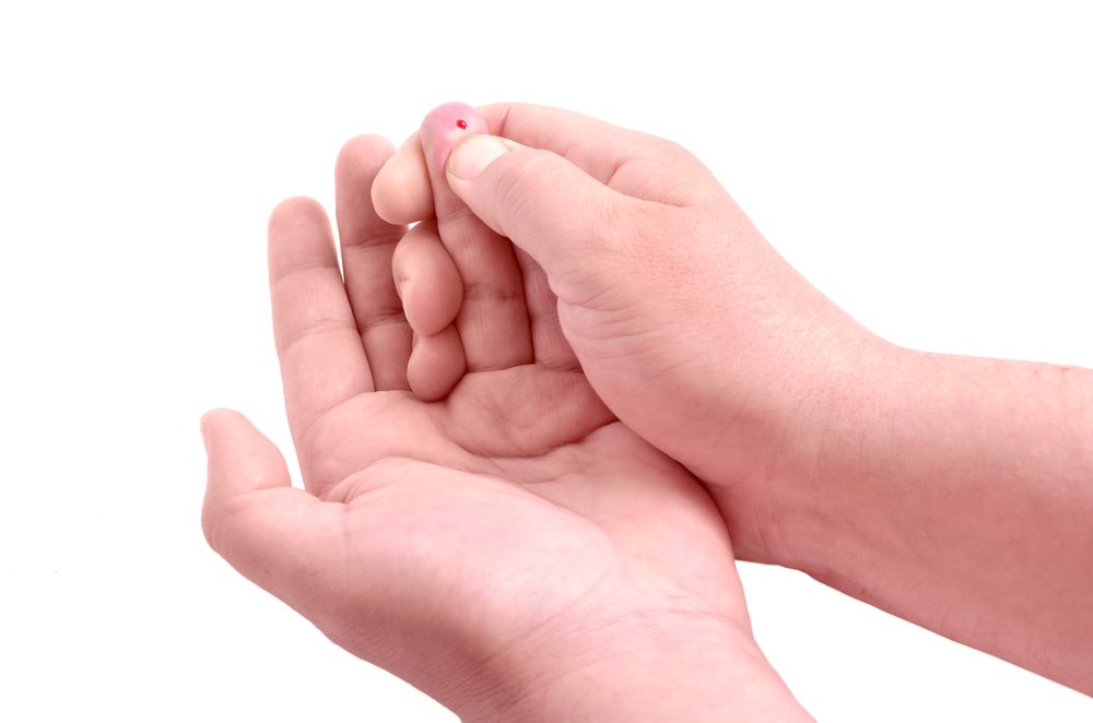 Is Loss Of An Incumbent Contract An Irreparable Injury PubKGroup